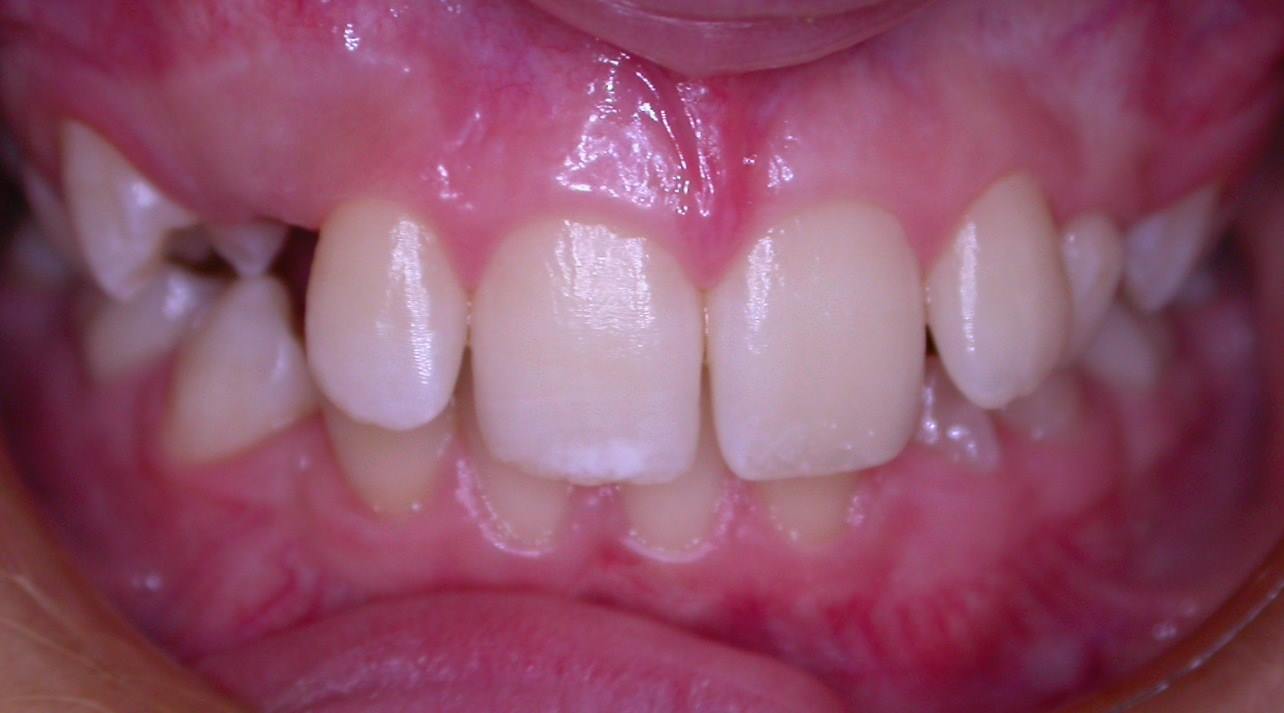 Smile Transformations: Before and After Photos | Today's Dentistry