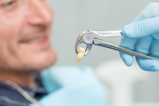 Safe Tooth Extraction Services in Brisbane | Today’s Dentistry