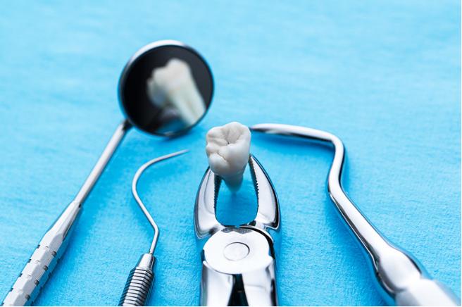 Safe Tooth Extraction Services in Brisbane | Today’s Dentistry